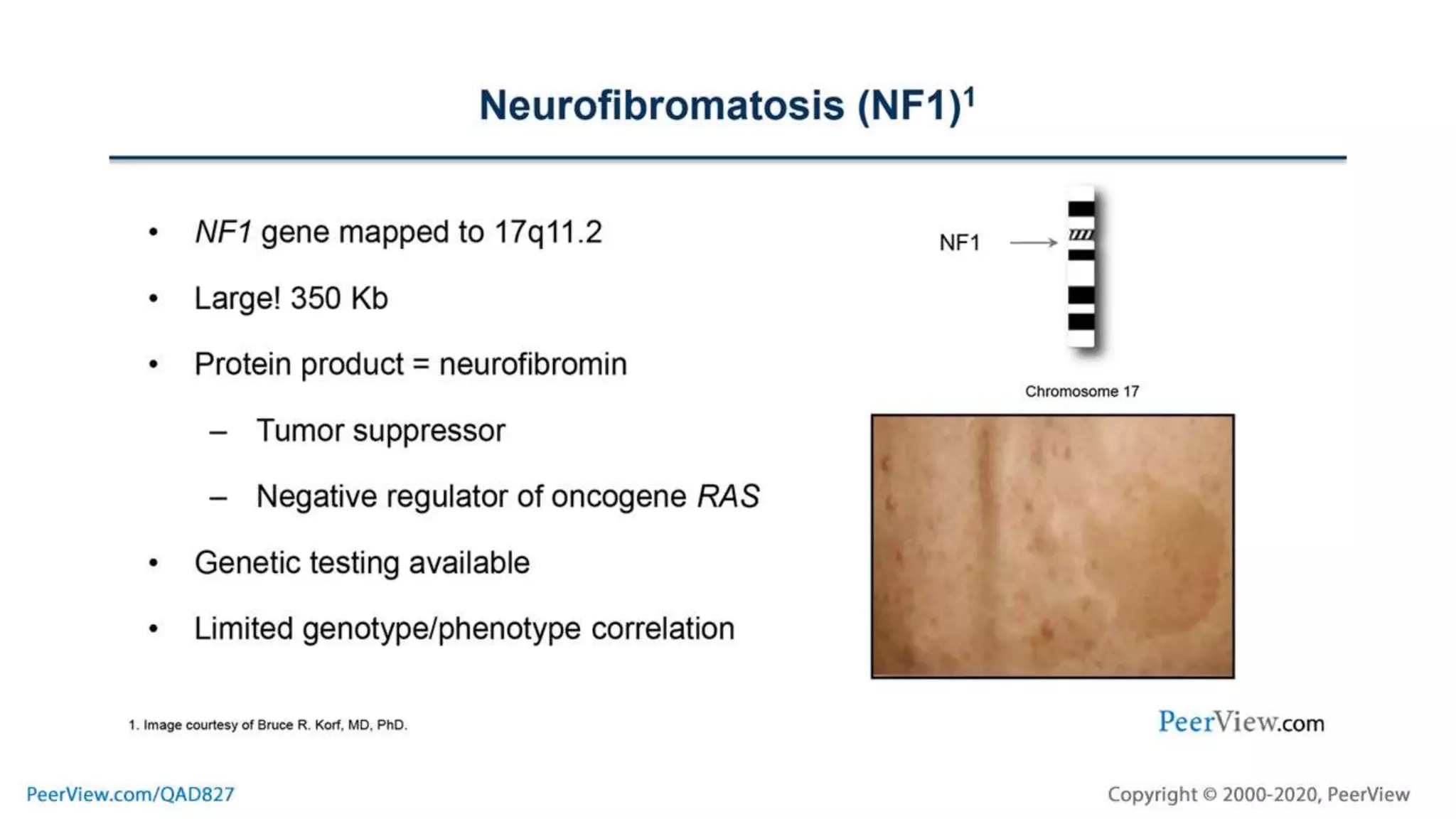 Targeting the RAS/MAPK Pathway in Neurofibromatosis Type 1 and ...