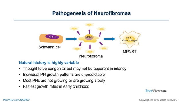 Targeting the RAS/MAPK Pathway in Neurofibromatosis Type 1 and ...
