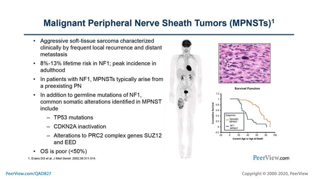Targeting the RAS/MAPK Pathway in Neurofibromatosis Type 1 and ...