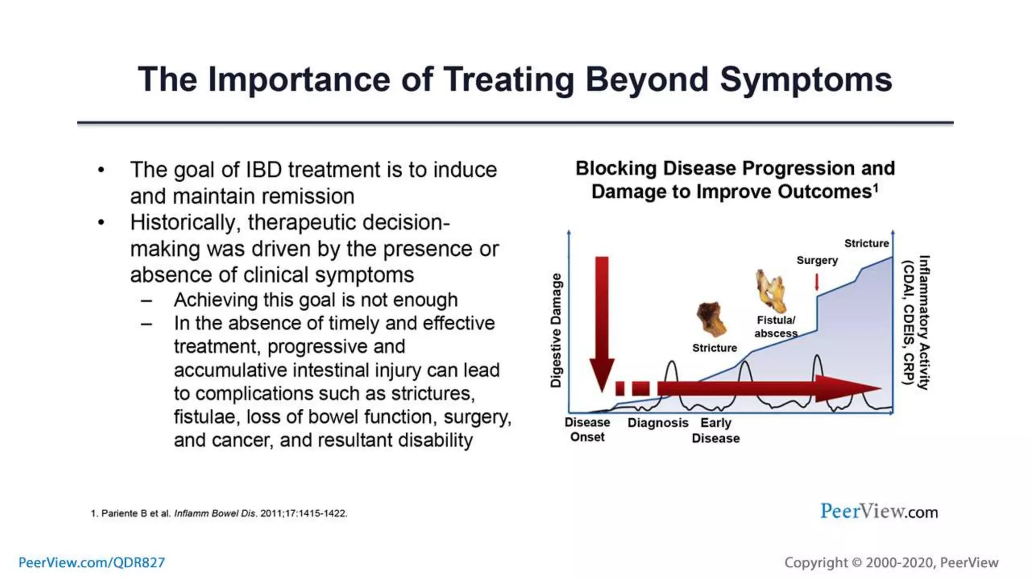Transforming the Management of Inflammatory Bowel Disease: A Closer Look at the Role of JAK ...