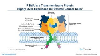 On Target: Understanding the Impact of PSMA for Diagnostic and ...