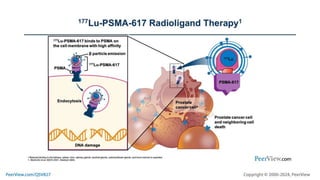 On Target: Understanding the Impact of PSMA for Diagnostic and ...