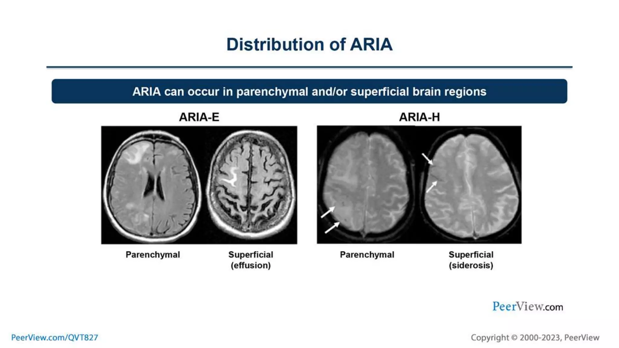 Case by Case: Actioning Patient-Centered Strategies for Risk Assessment ...