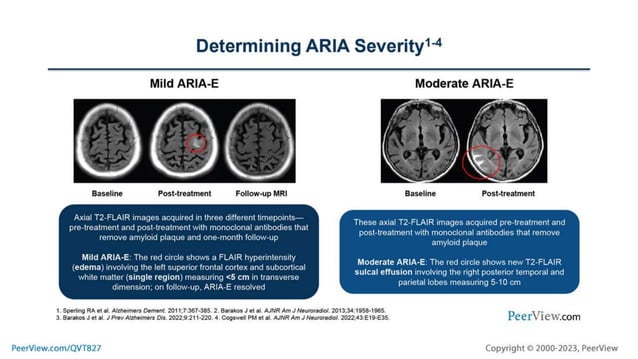 Case by Case: Actioning Patient-Centered Strategies for Risk Assessment ...