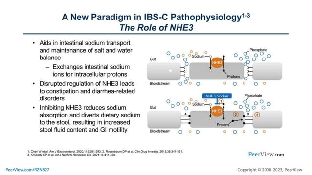 Addressing Unmet Nursing Needs in the Management of IBS-C: Understanding the Mechanism of ...