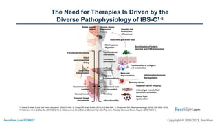 Addressing Unmet Nursing Needs in the Management of IBS-C: Understanding the Mechanism of ...