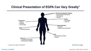 Overcoming Challenges Associated With the Diagnosis and Management of EGPA: An Exploration of ...