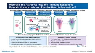 Exploring New Frontiers in Alzheimer’s Disease: Early Detection ...