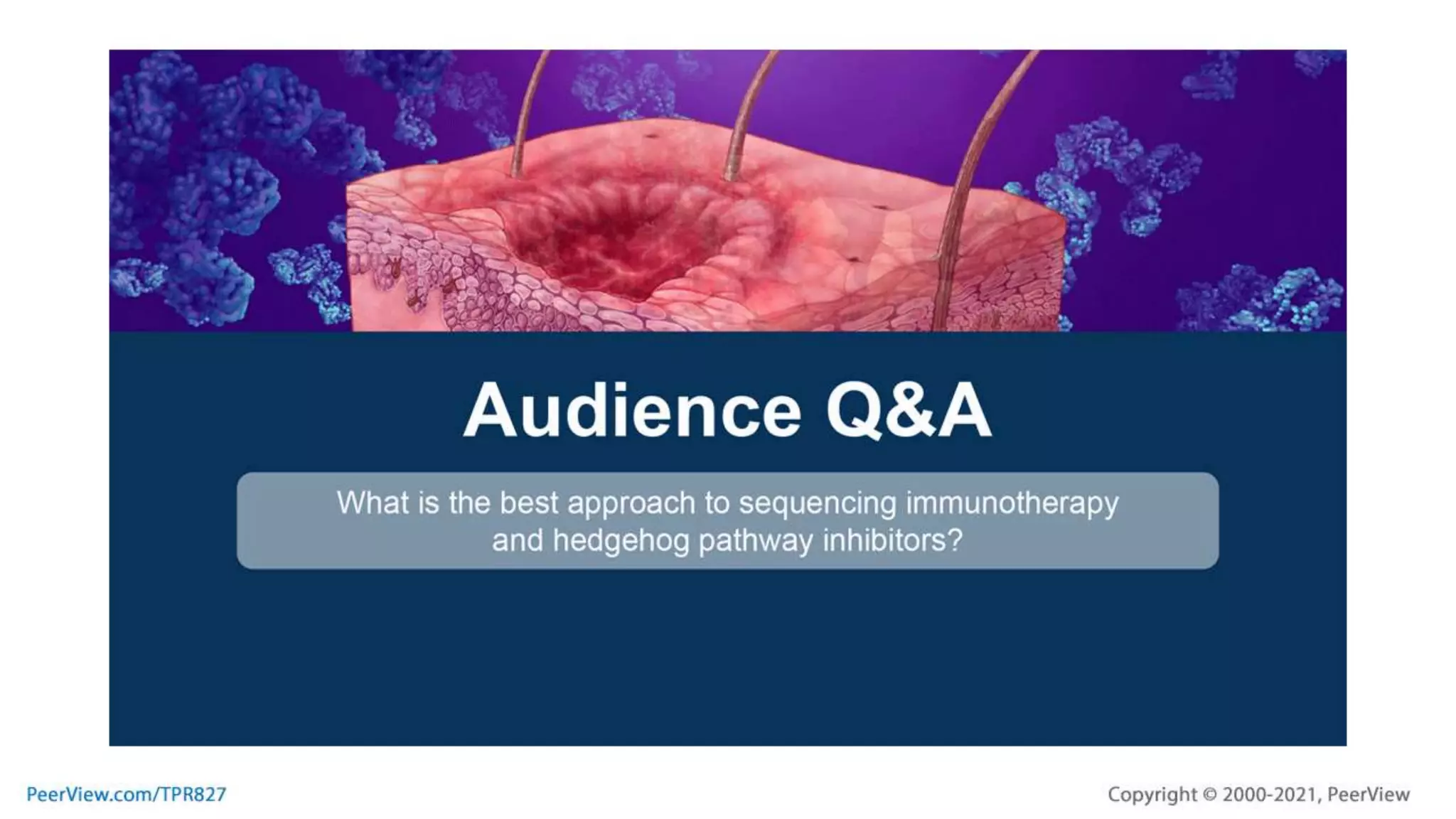 Innovative Immunotherapy in Advanced Basal Cell Carcinoma: Evolving ...