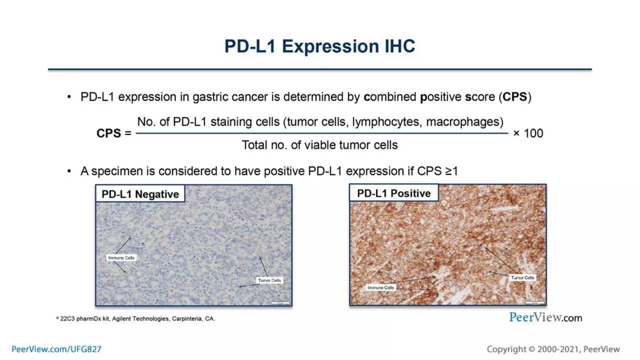 Checkpoint Inhibition in Gastrointestinal Cancers: Recent Advances in ...