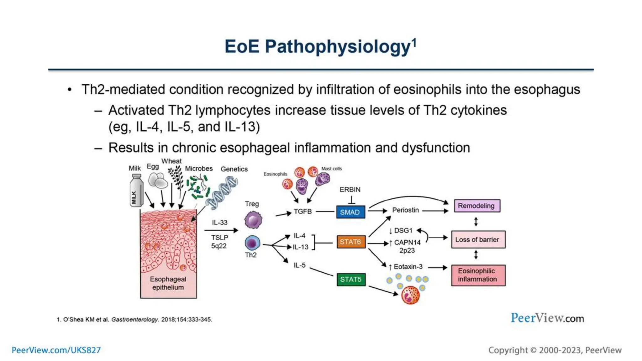 Facing the Challenges of EoE Head On: A Game Plan for Diagnosis and ...