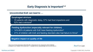 Facing the Challenges of EoE Head On: A Game Plan for Diagnosis and ...