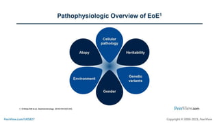 Facing the Challenges of EoE Head On: A Game Plan for Diagnosis and ...