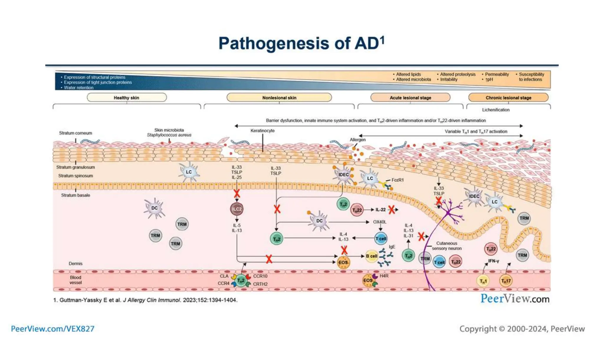Interdisciplinary Approaches to Management of Immune-Mediated ...