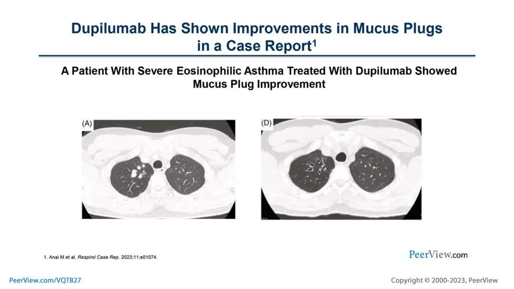Beyond Airway Inflammation: Examining the Potential Clinical Utility of ...