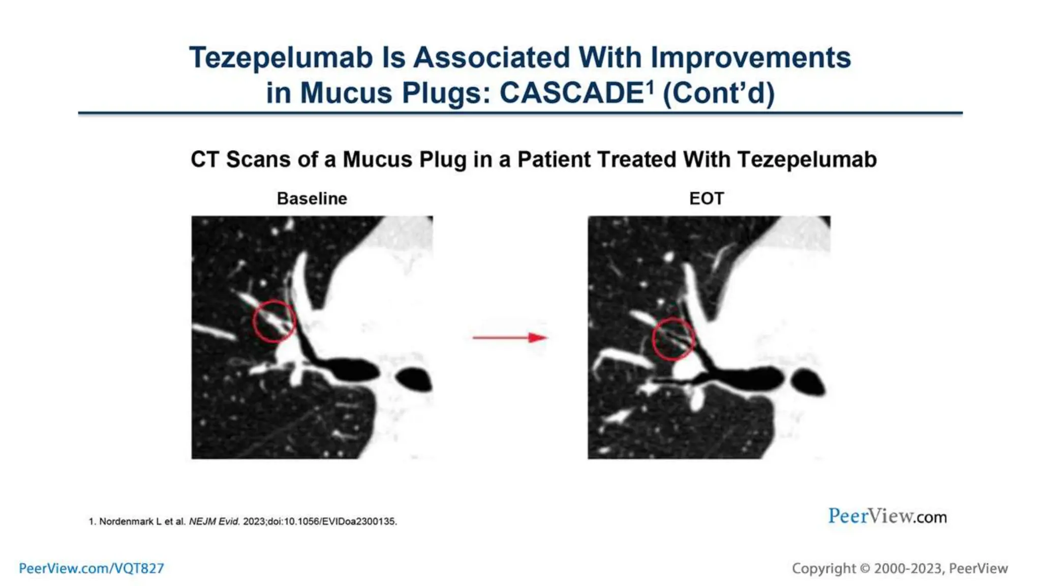 Beyond Airway Inflammation: Examining the Potential Clinical Utility of ...