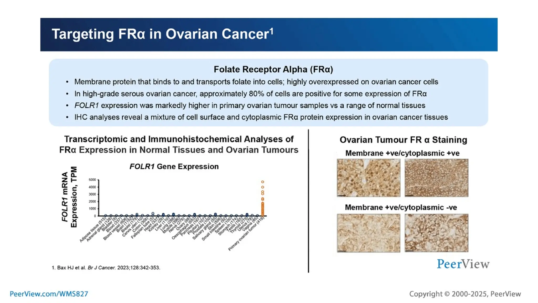 Putting the Puzzle Together in Advanced Ovarian and Cervical Cancers ...