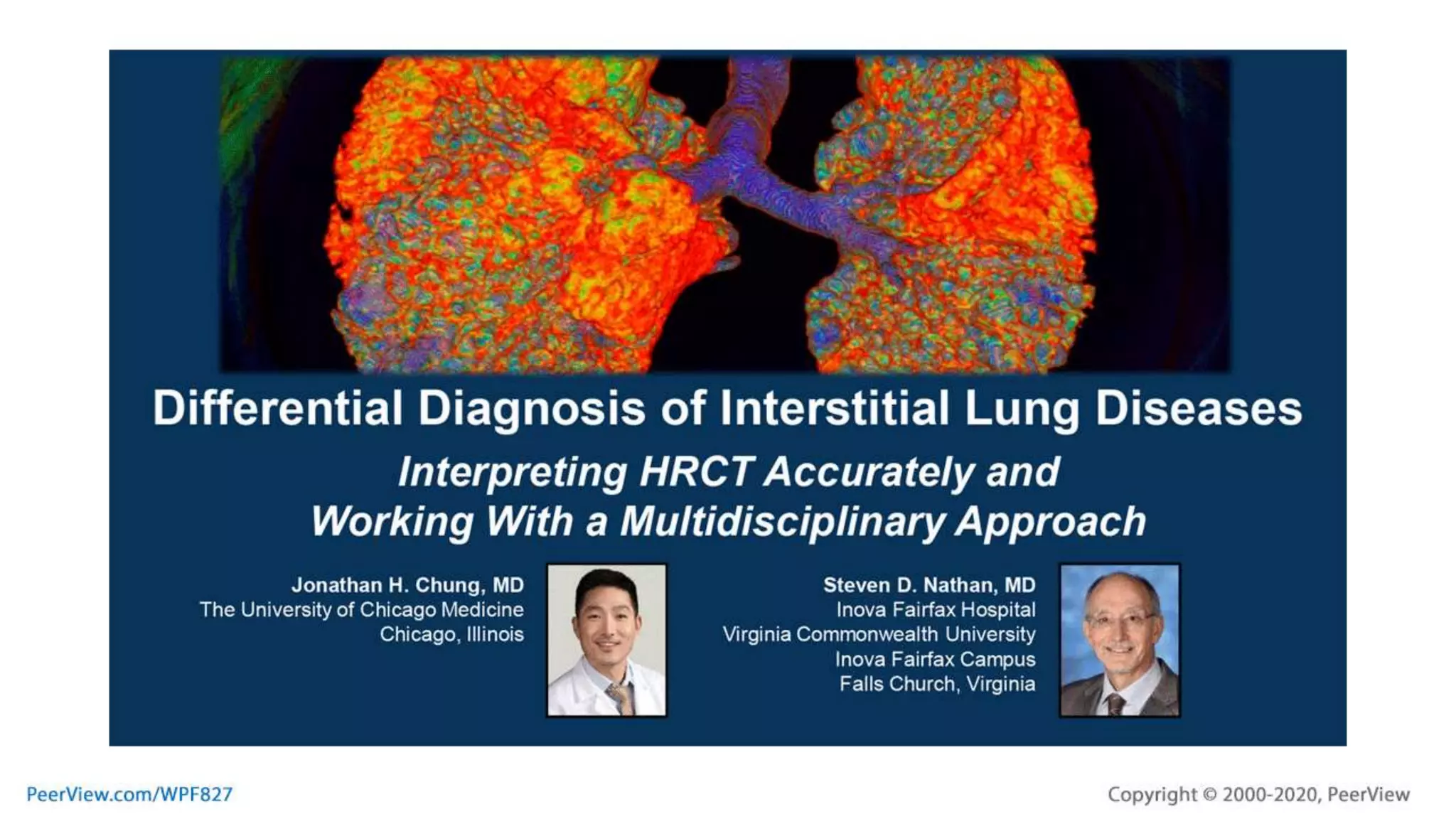 Differential Diagnosis of Interstitial Lung Diseases: Interpreting HRCT Accurately and Working ...