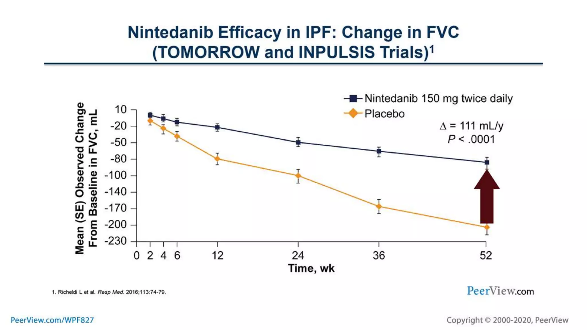 Differential Diagnosis of Interstitial Lung Diseases: Interpreting HRCT ...