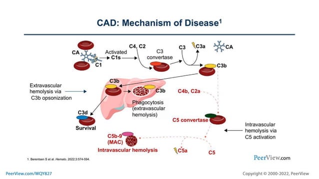 Demystifying Cold Agglutinin Disease: A Visual Exploration of Mechanism ...