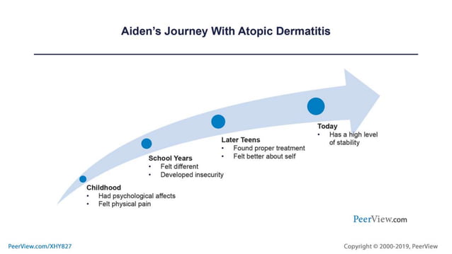 A Closer Look at the Atopic Dermatitis Patient Journey: Effective ...