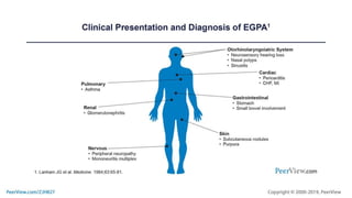 Relieving the Burden of EGPA: Examining the Latest Advances in ...