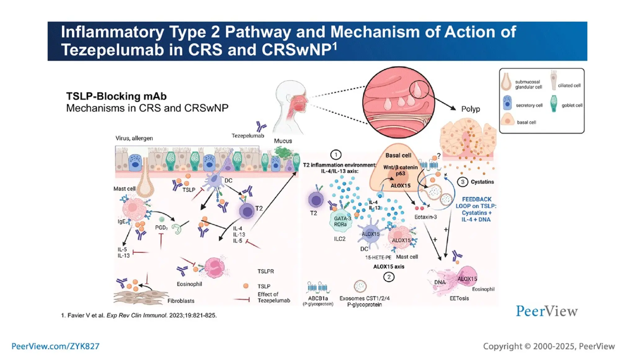 Tackling CRSwNP Management With Emerging Biologic Therapies Targeting ...