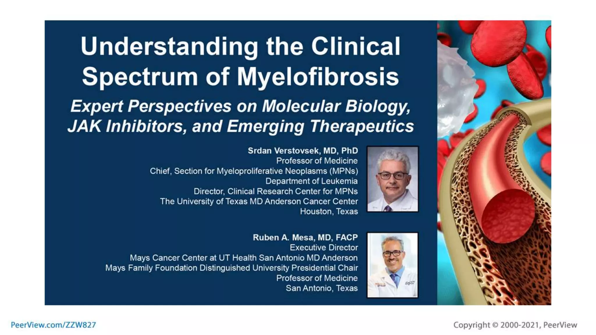 Understanding the Clinical Spectrum of Myelofibrosis: Expert ...