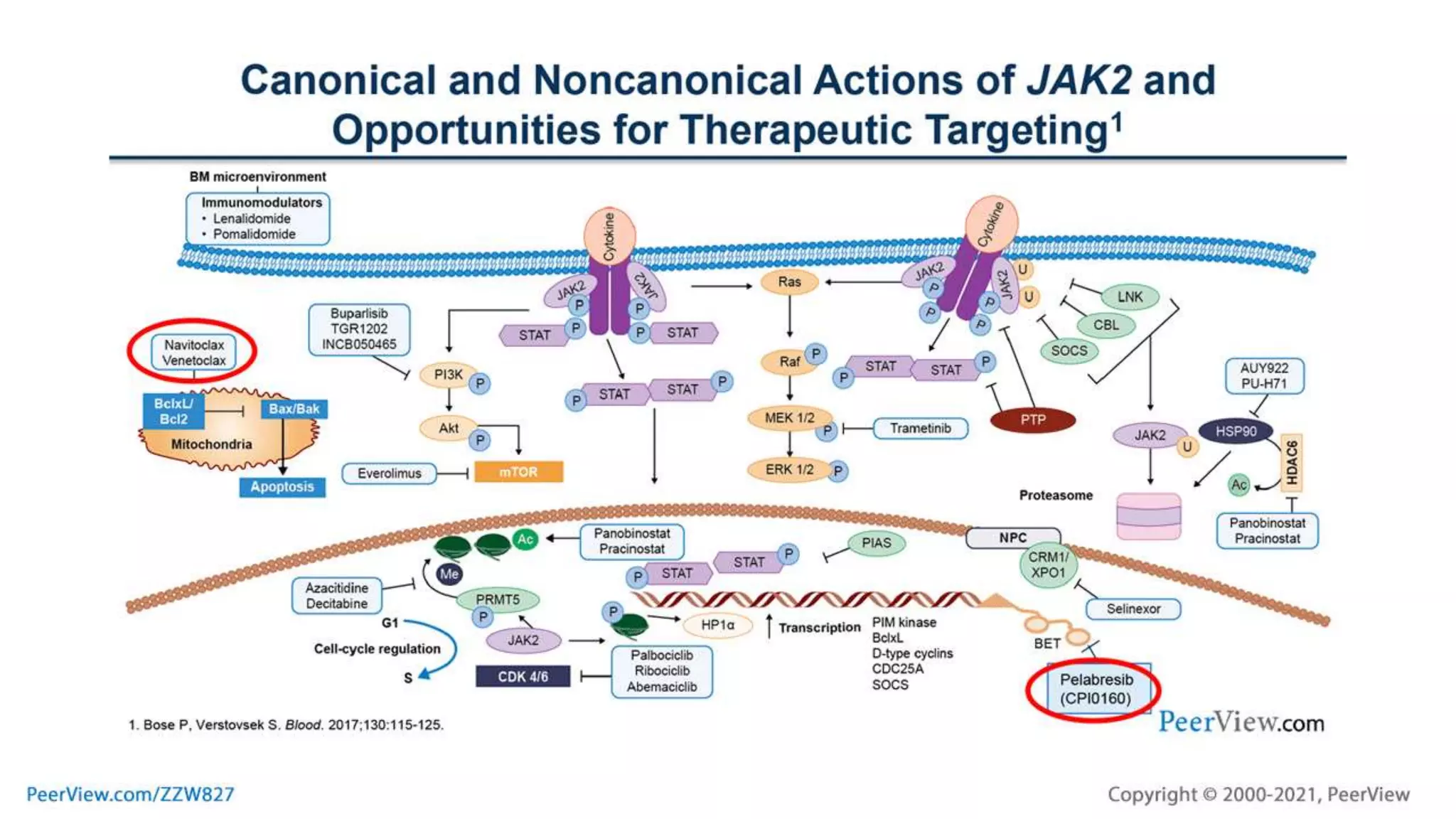 Understanding the Clinical Spectrum of Myelofibrosis: Expert ...