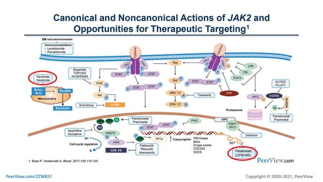 Understanding the Clinical Spectrum of Myelofibrosis: Expert ...