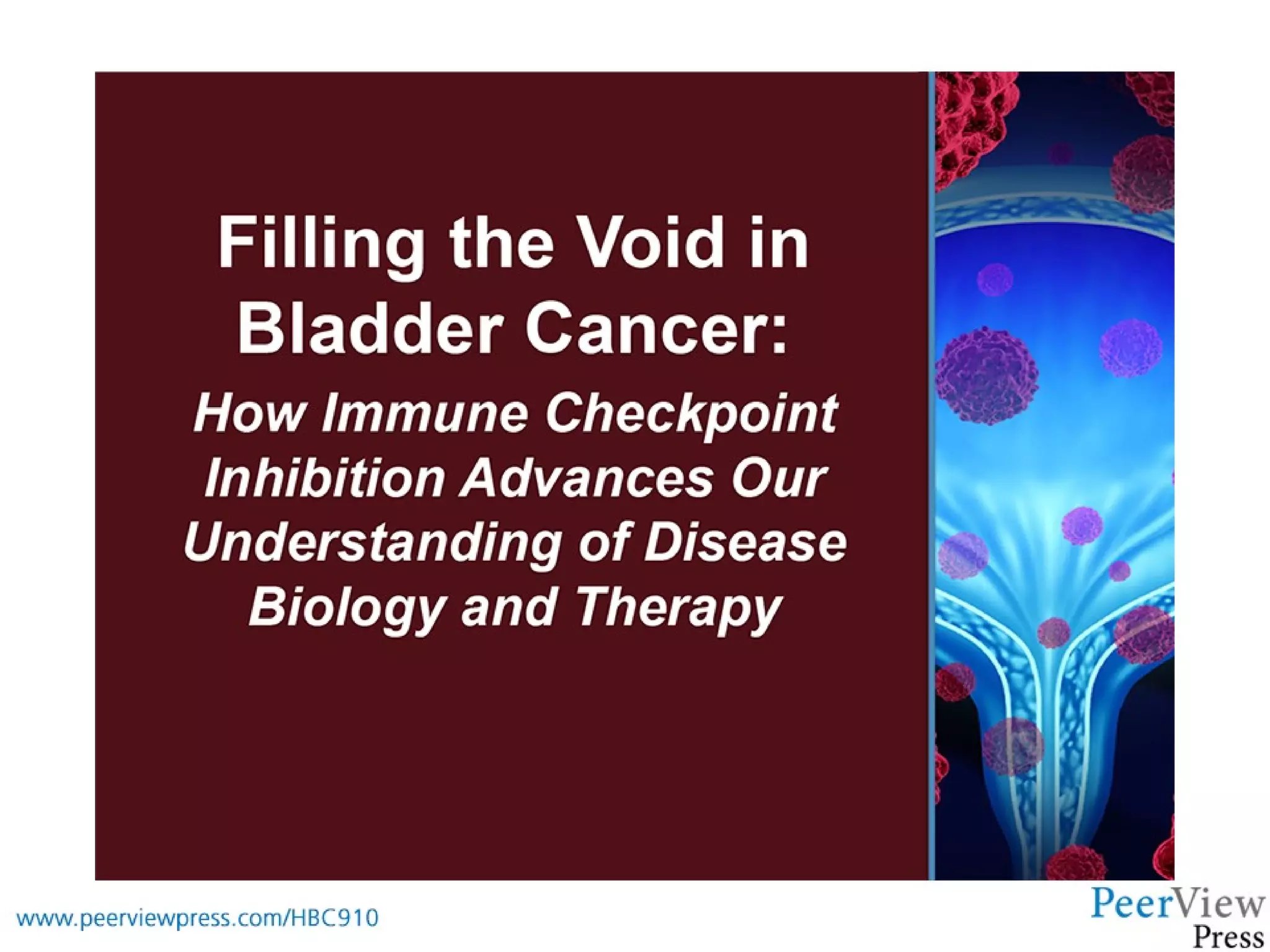 Filling the Void in Bladder Cancer: How Immune Checkpoint Inhibition ...