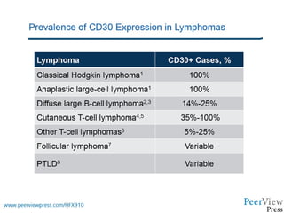 Expert Thoughts on Managing CD30-Expressing Lymphoma: From Disease ...