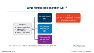 Large Hemispheric Infarction: Exploring the Latest Clinical Advances in ...