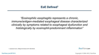The Latest on New Options for Eosinophilic Esophagitis: Considering ...
