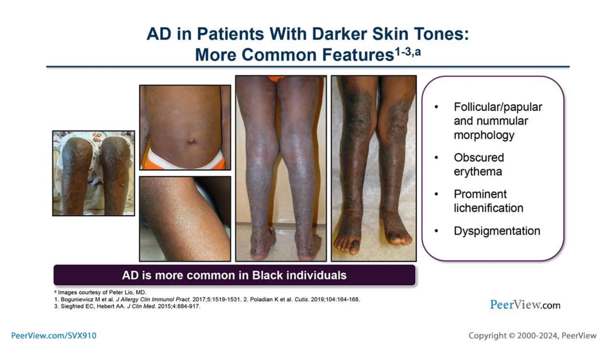 Evolving Concepts in the Pathogenesis of Inflammatory Dermatologic ...