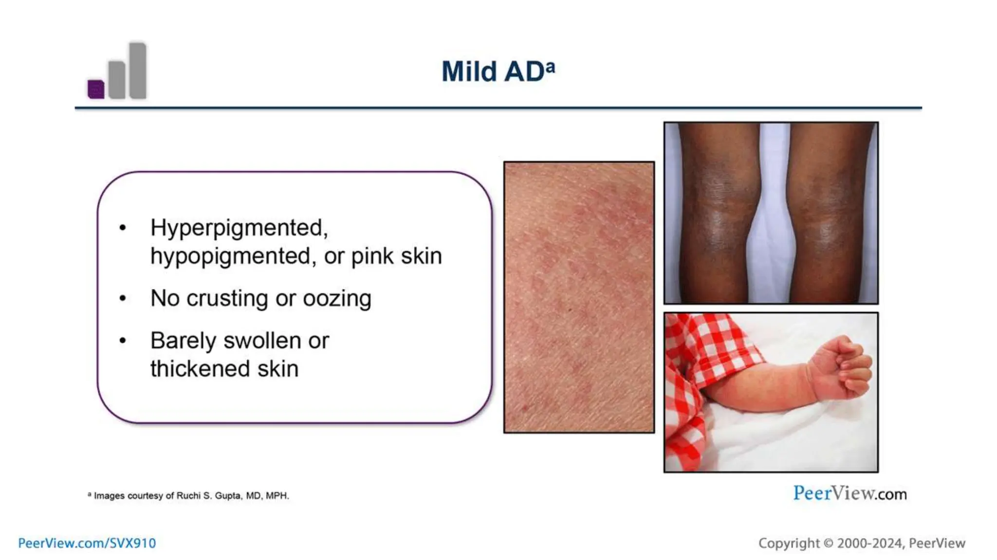 Evolving Concepts in the Pathogenesis of Inflammatory Dermatologic ...