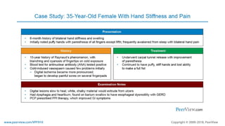 Systemic Sclerosis-Associated Interstitial Lung Disease (SSc-ILD ...