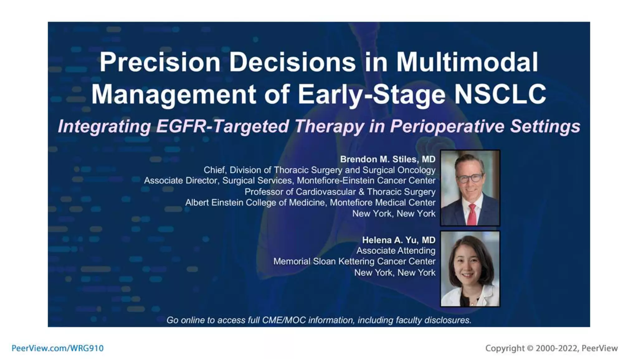 Precision Decisions in Multimodal Management of Early-Stage NSCLC ...