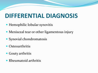 Pigmented villonodular synovitis | PPTX