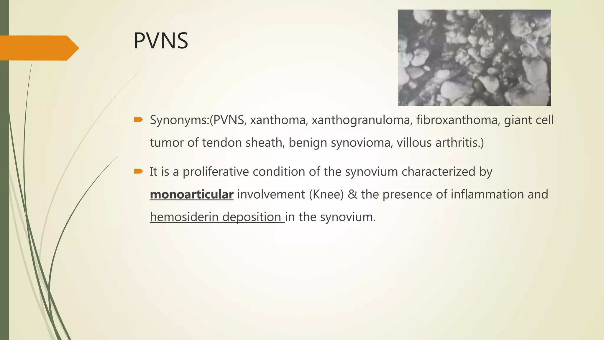 PVNS,SYNOVIAL CHONDROMATOSIS & LOOSE BODIES | PPTX