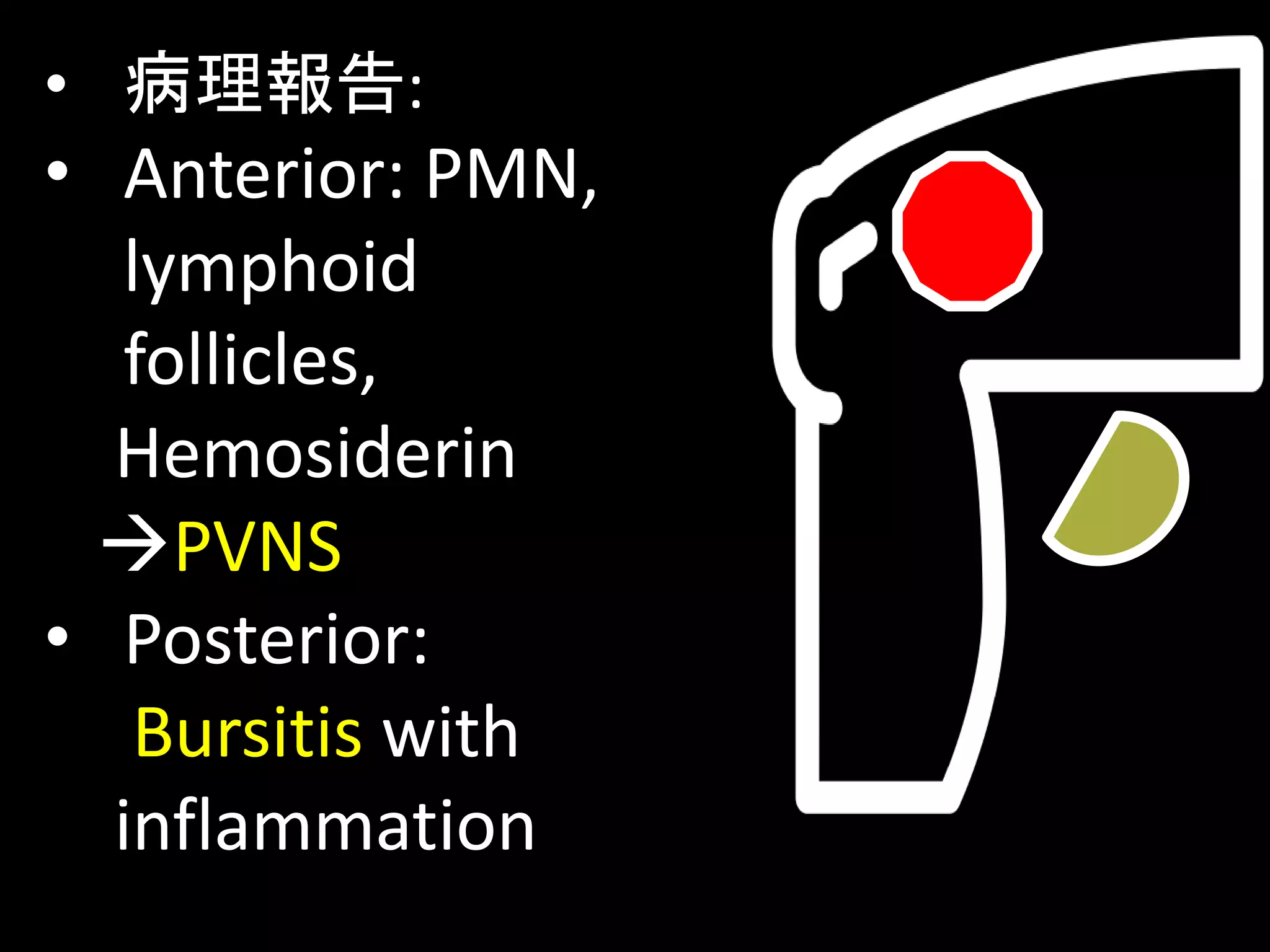 Pigment villos nodular Synovitis PVNS | PPT