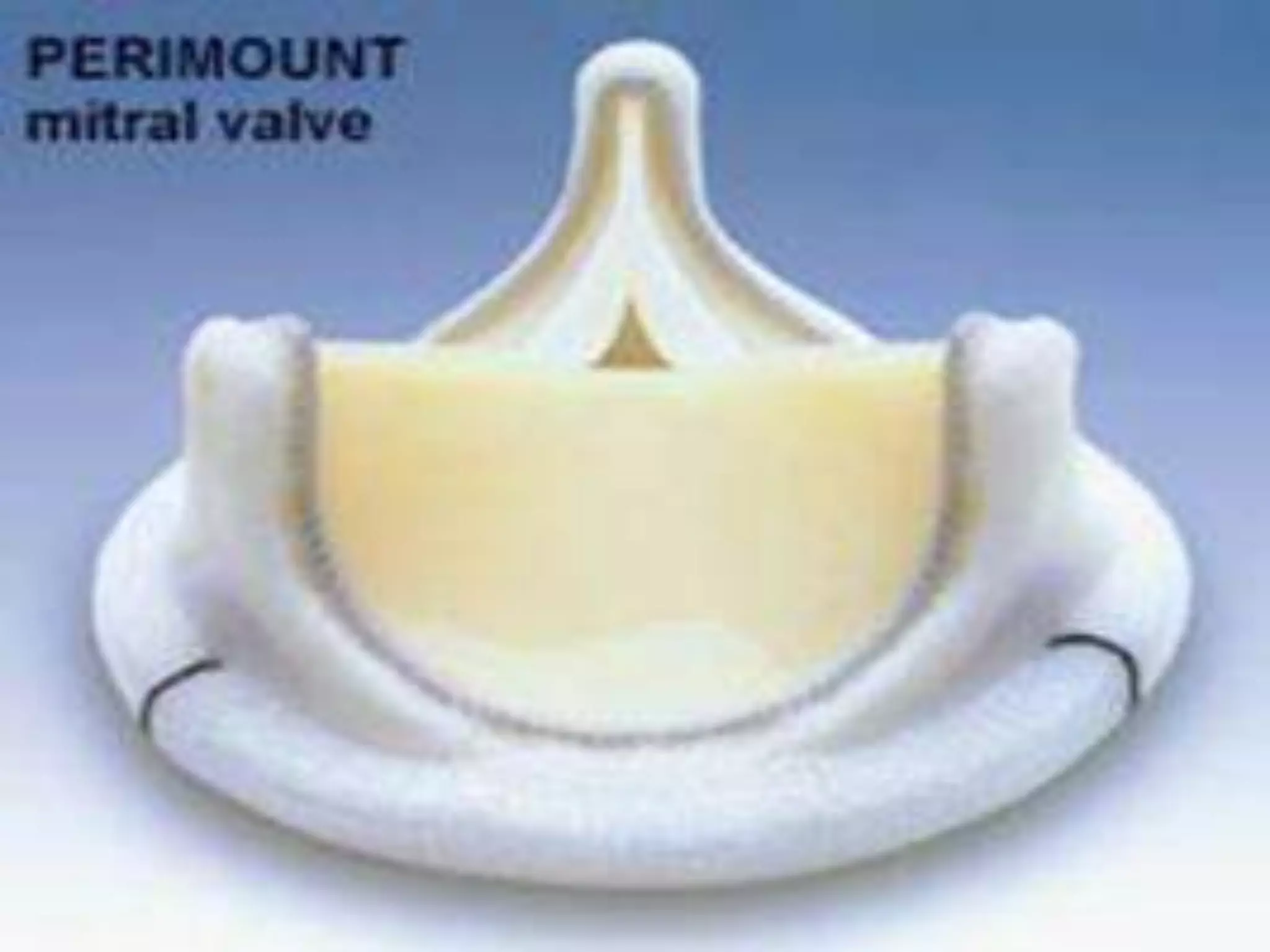 PROSTHETIC VALVES | PPTX