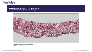 The Central Role of Renal Pathology in the Differential Diagnosis of ...