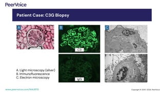 The Central Role of Renal Pathology in the Differential Diagnosis of ...