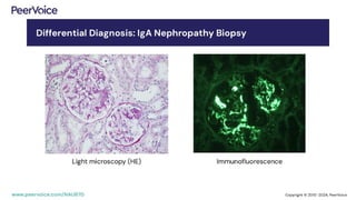 The Central Role of Renal Pathology in the Differential Diagnosis of ...