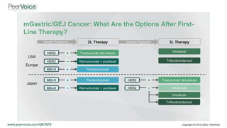 Here’s The Challenge! Overcoming Tumour Heterogeneity in Gastric/GEJ ...