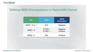 Here’s The Challenge! Overcoming Tumour Heterogeneity in Gastric/GEJ ...
