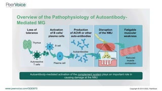 Complement-Mediated Attack of the Neuromuscular Junction in gMG: The C5 ...