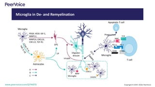 Navigating the High-Efficacy DMT Landscape in MS: Integrating New Data ...