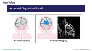 Are You Managing Pregnant Individuals? Then You Need to Know About ...